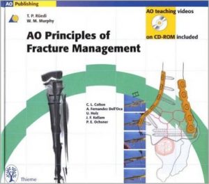 Ao Principles of Fracture Management | CtsQena