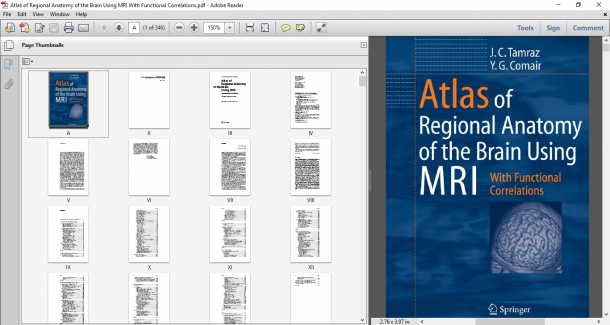 Atlas of Regional Anatomy of the Brain Using MRI: With Functional ...
