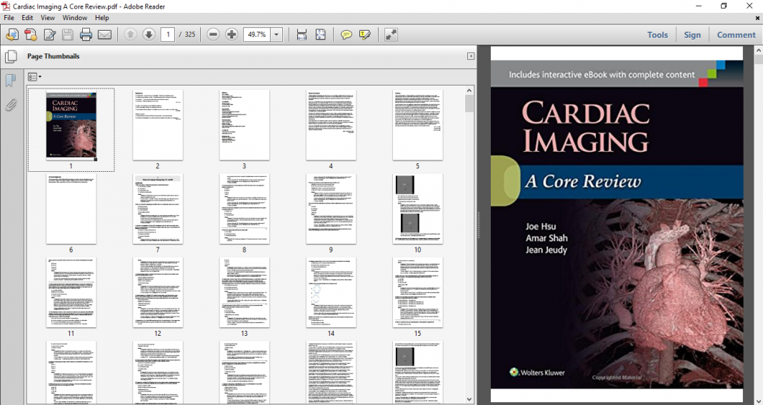 Cardiac Imaging: A Core Review First Edition | CtsQena