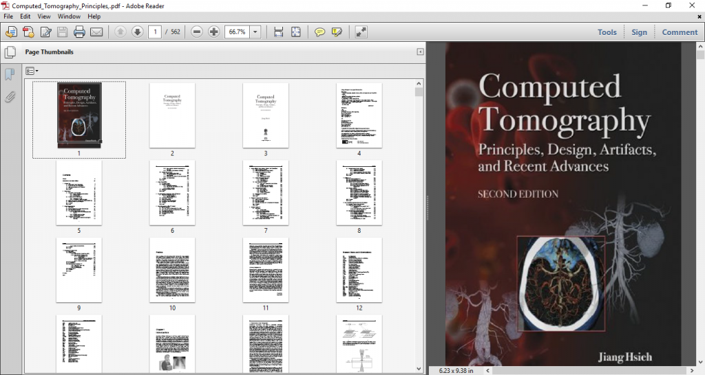Computed Tomography Principles, Design, Artifacts, and Recent Advances ...