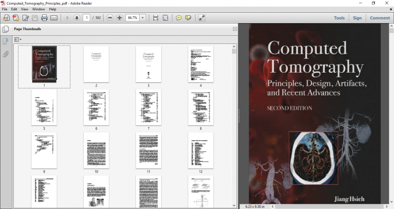 Computed Tomography Principles, Design, Artifacts, and Recent Advances ...