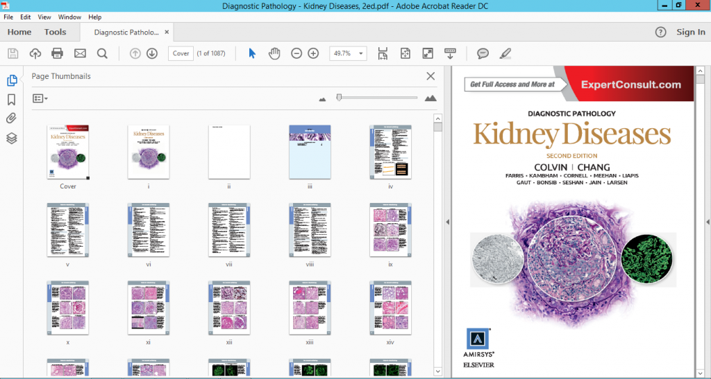 Diagnostic Pathology: Kidney Diseases, 2e 2nd Edition | CtsQena