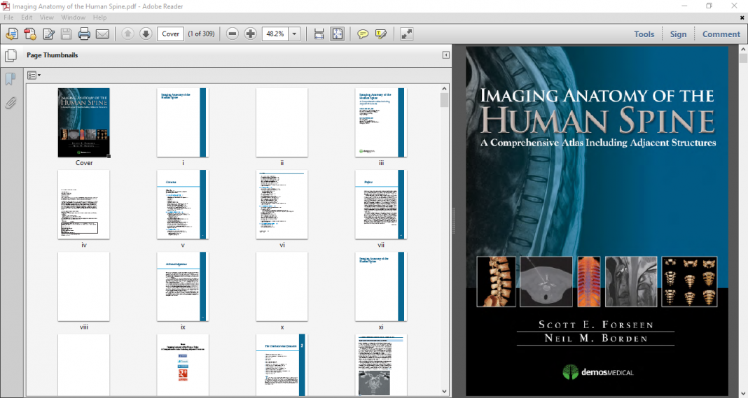 Imaging Anatomy of the Human Spine: A Comprehensive Atlas Including ...