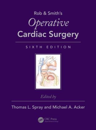 Cardiac Surgery: A Complete Guide 1st ed. 2020 Edition PDF | CtsQena