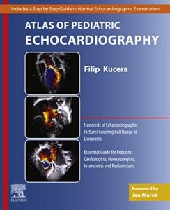 Atlas of Pediatric Echocardiography 1st Edition PDF | CtsQena